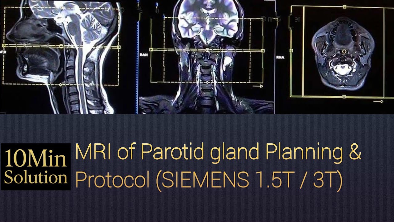 MRI of Parotid Gland | Complete Planning & Protocol Guide (1.5T/3T ...