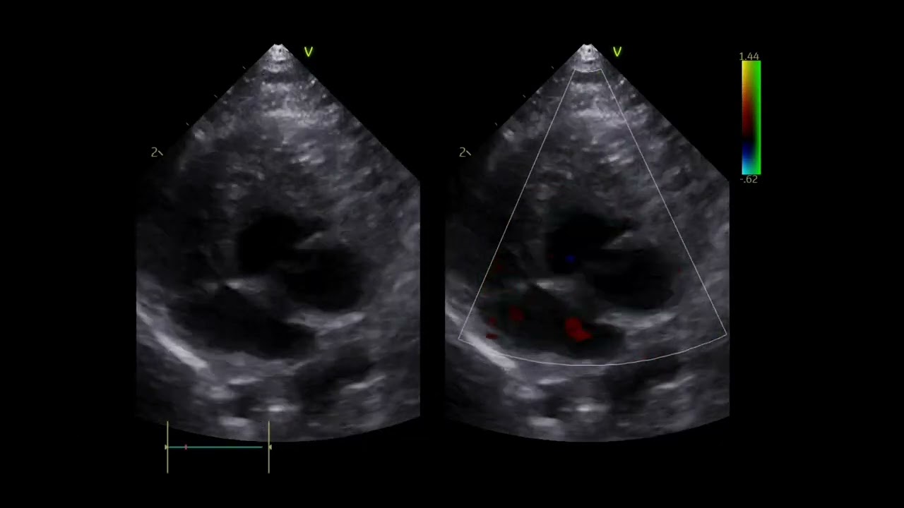 Feline supramitral valvular Ring 💍🐱 #veterinarycardiology # ...