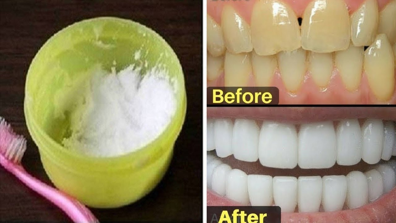 How to get rid of yellow teeth fast immediately at home, Turn your deep ...