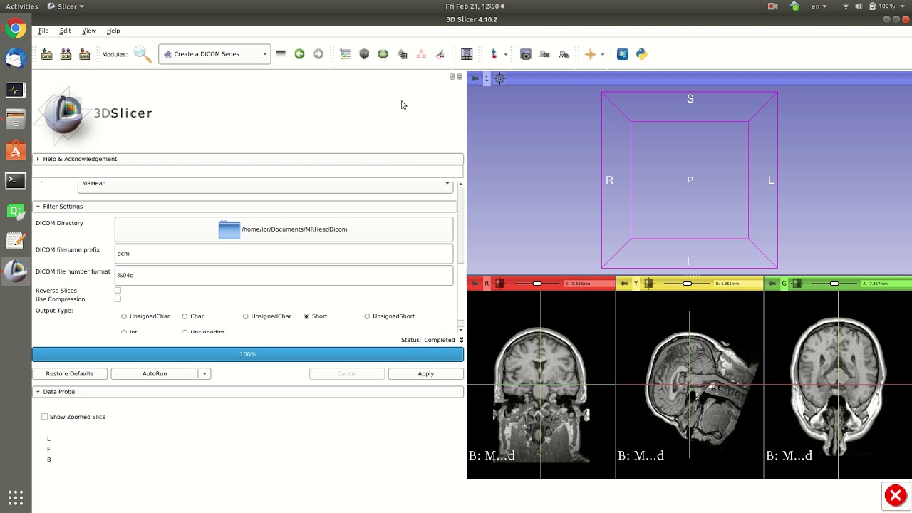 Slicer 2020 06 Creating DICOM Image using 3D Slicer - YouTube