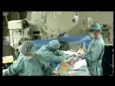 Cardiac Surgeon Interview - YouTube
