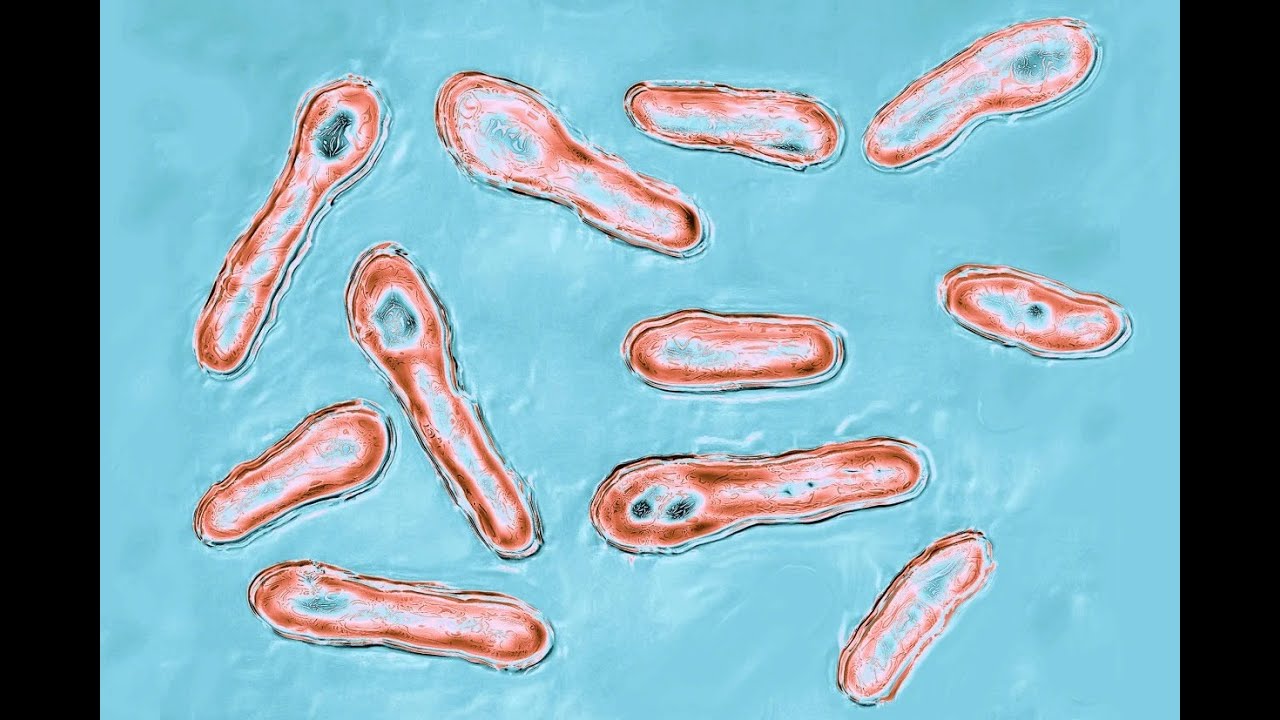 Clostridium Botulinum ; Classification, Description, Significance ...