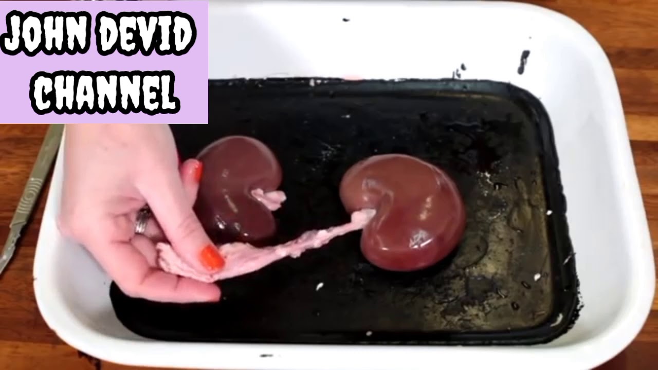 Kidney Excretory System Dissection GCSE A Level Biology NEET Practical ...