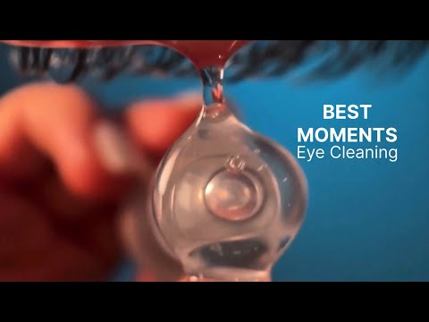Eye Cleaning Best Moments (1 Hour ASMR)