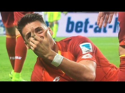 Sandro Wagner's finger injury is bad to watch.Hoffenheim's Sandro ...
