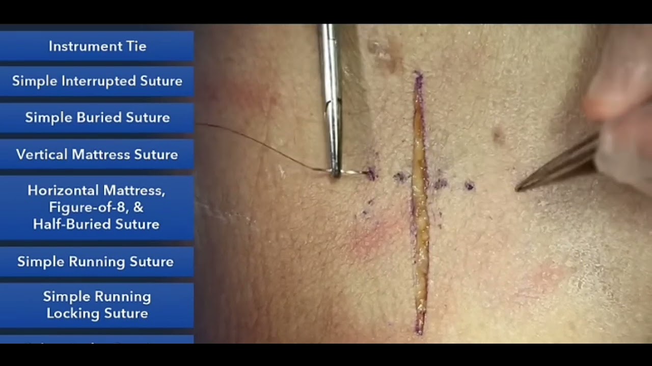 sutures skills | stitch methods |easy demonstration - YouTube
