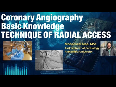 Coronary Angiography Technique (radial access) - YouTube