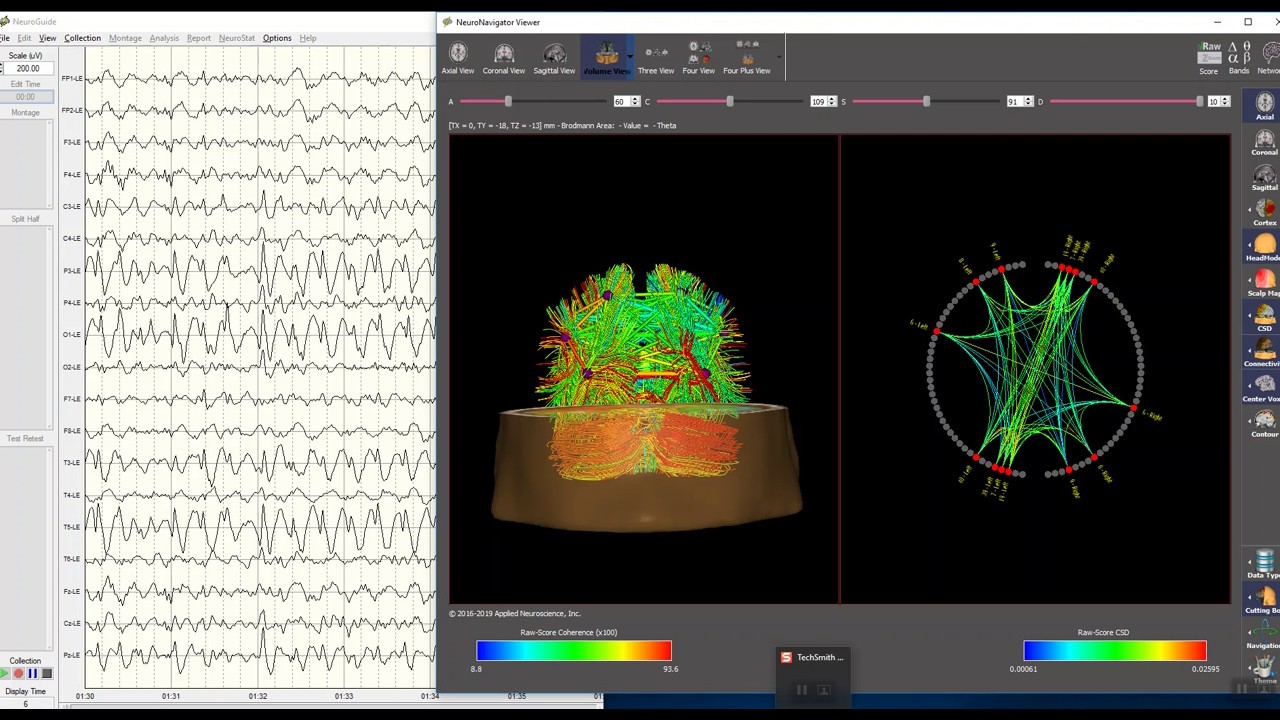 NeuroGuide NeuroNavigator Connectome in Real-Time - YouTube