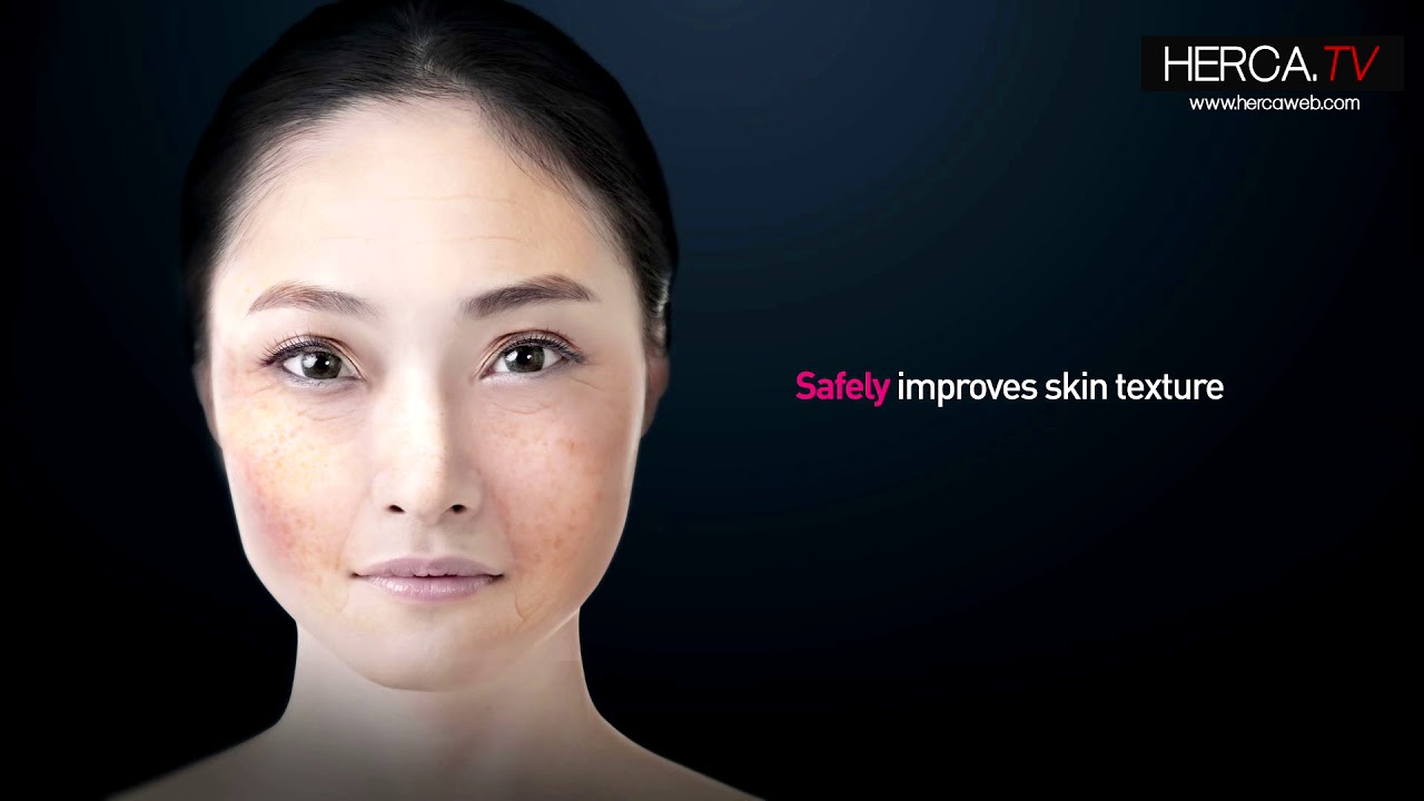 Pico Laser - HERCA - YouTube