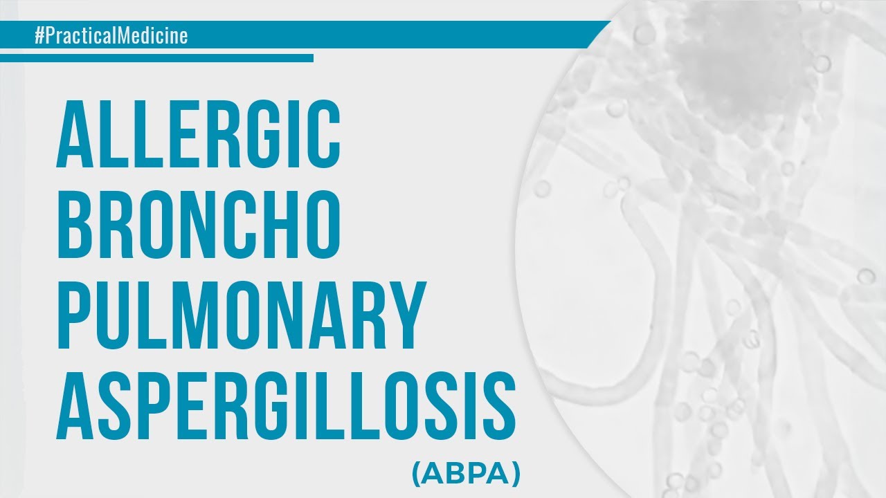 Allergic Broncho-Pulmonary Aspergillosis (ABPA) - YouTube