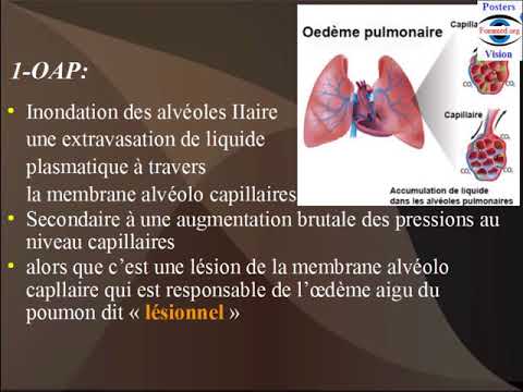 le Poumon Cardiaque - YouTube