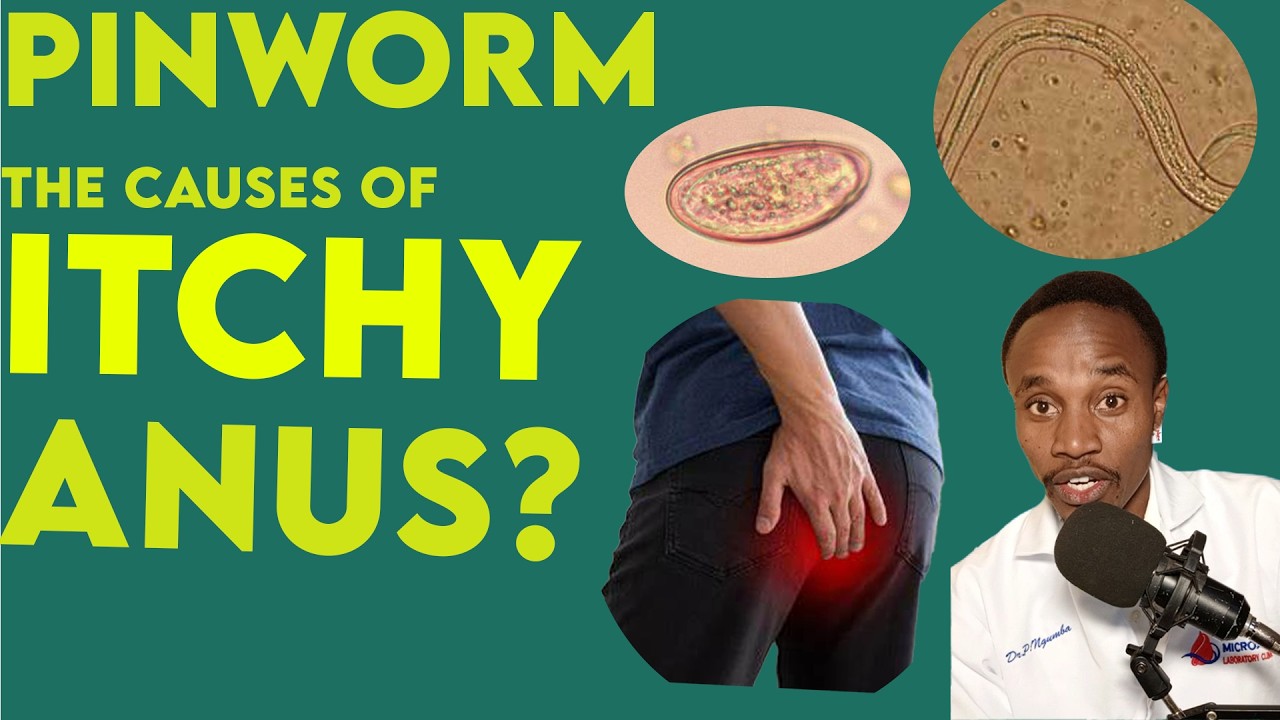 PINWORM Infections Are Skyrocketing - What You Need to Know! - YouTube