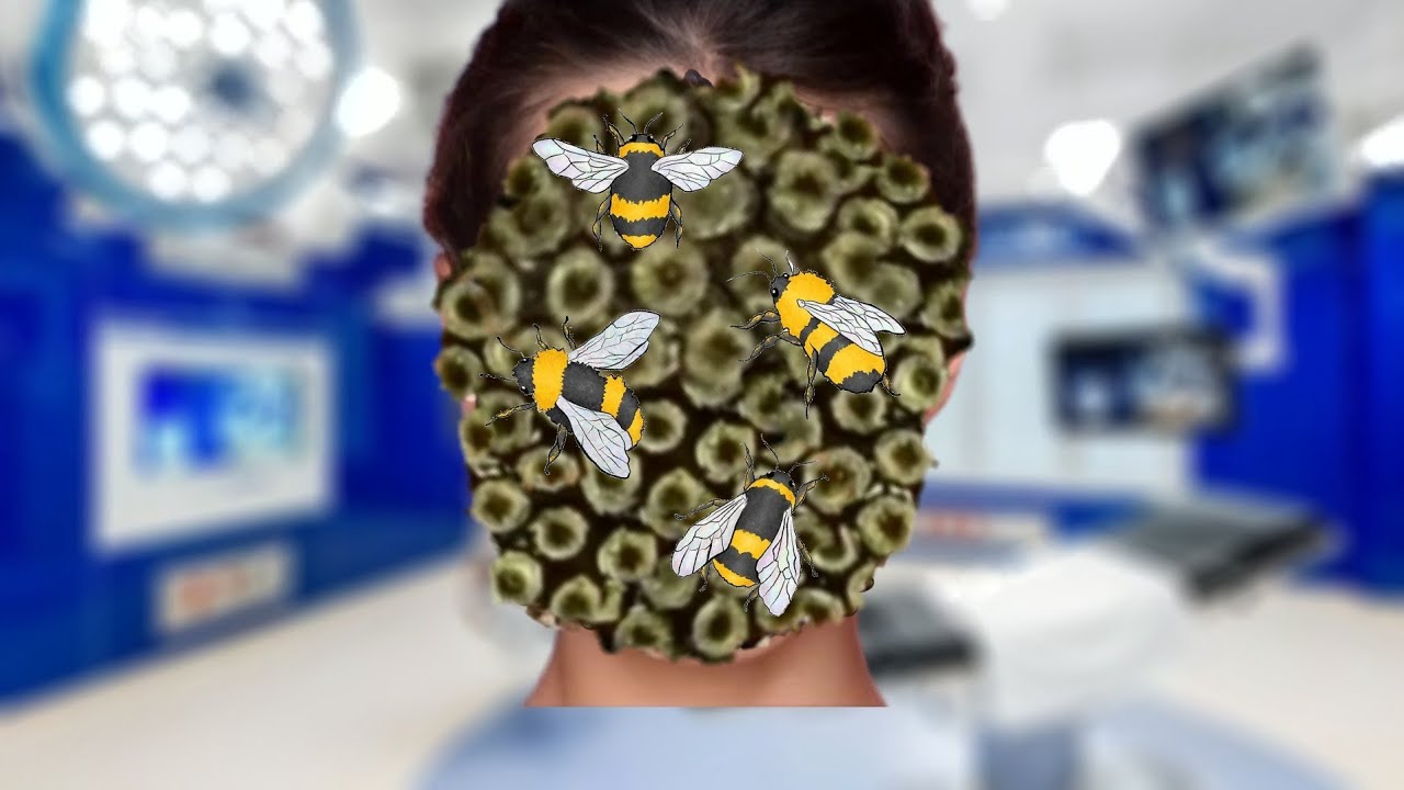 ASMR Young Girl Face Defected Treatment |Tripophobia Animation #asmr ...