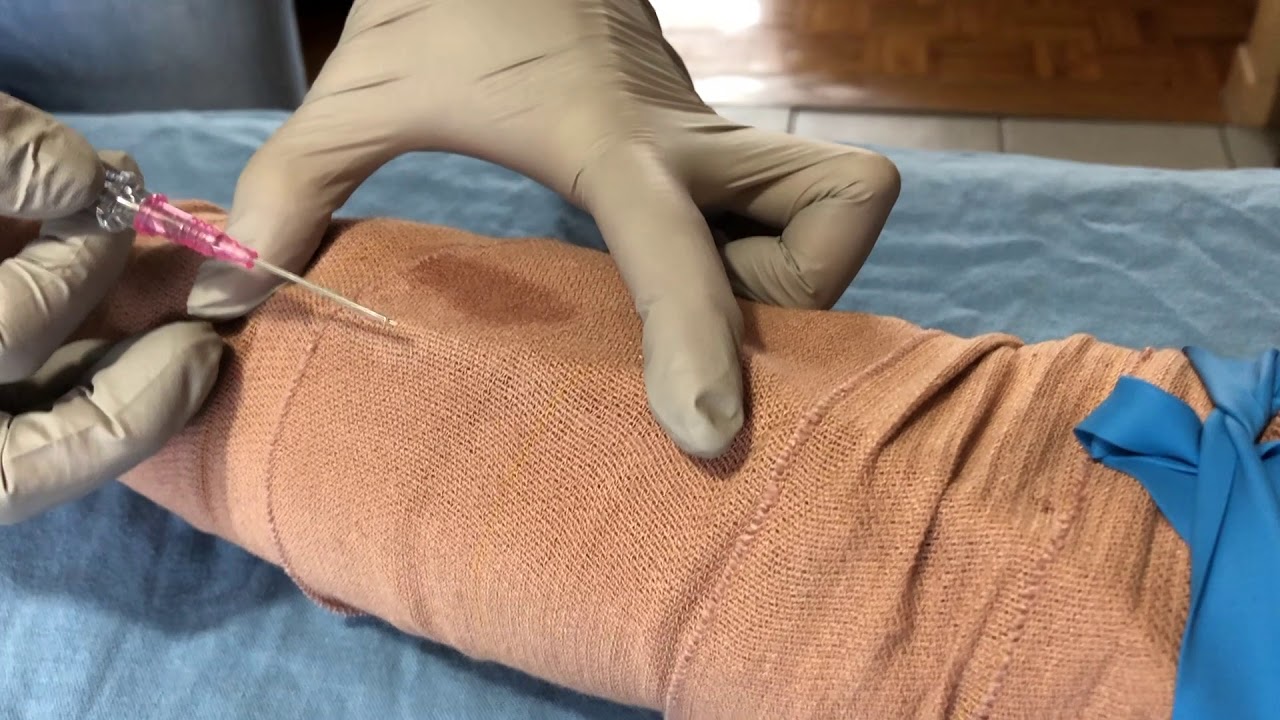 Installation du cathlon - YouTube