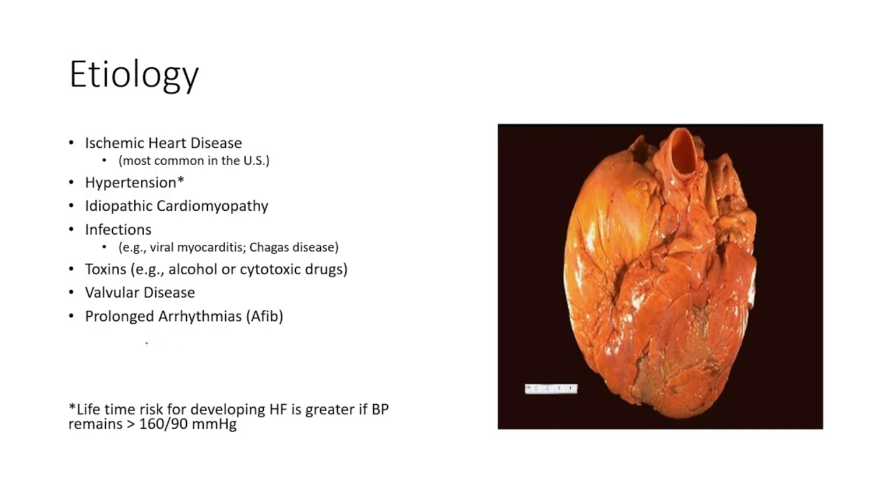 Heart Failure 1: Introduction - YouTube