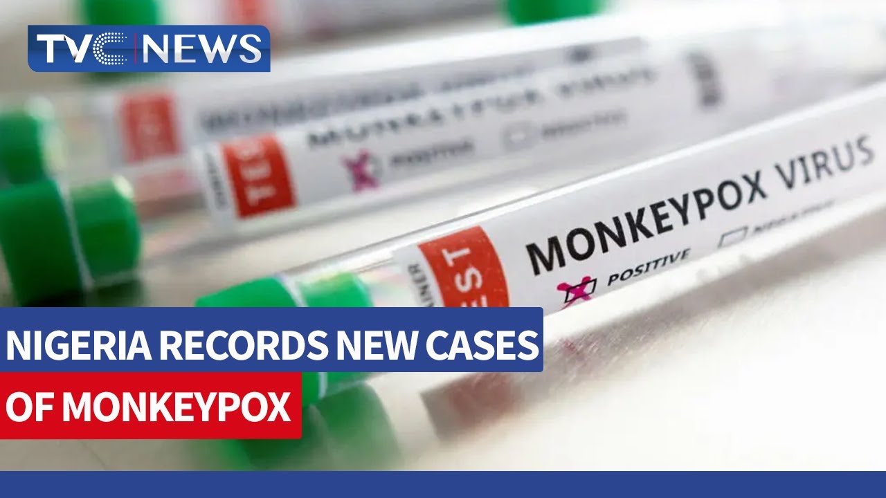 Nigeria Records Six New Cases Of Monkeypox, One Death In One Week - YouTube