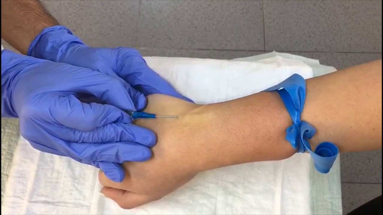 Canalizacion De Via Venosa Periferica Terapia Intravenosa Lavado De Images