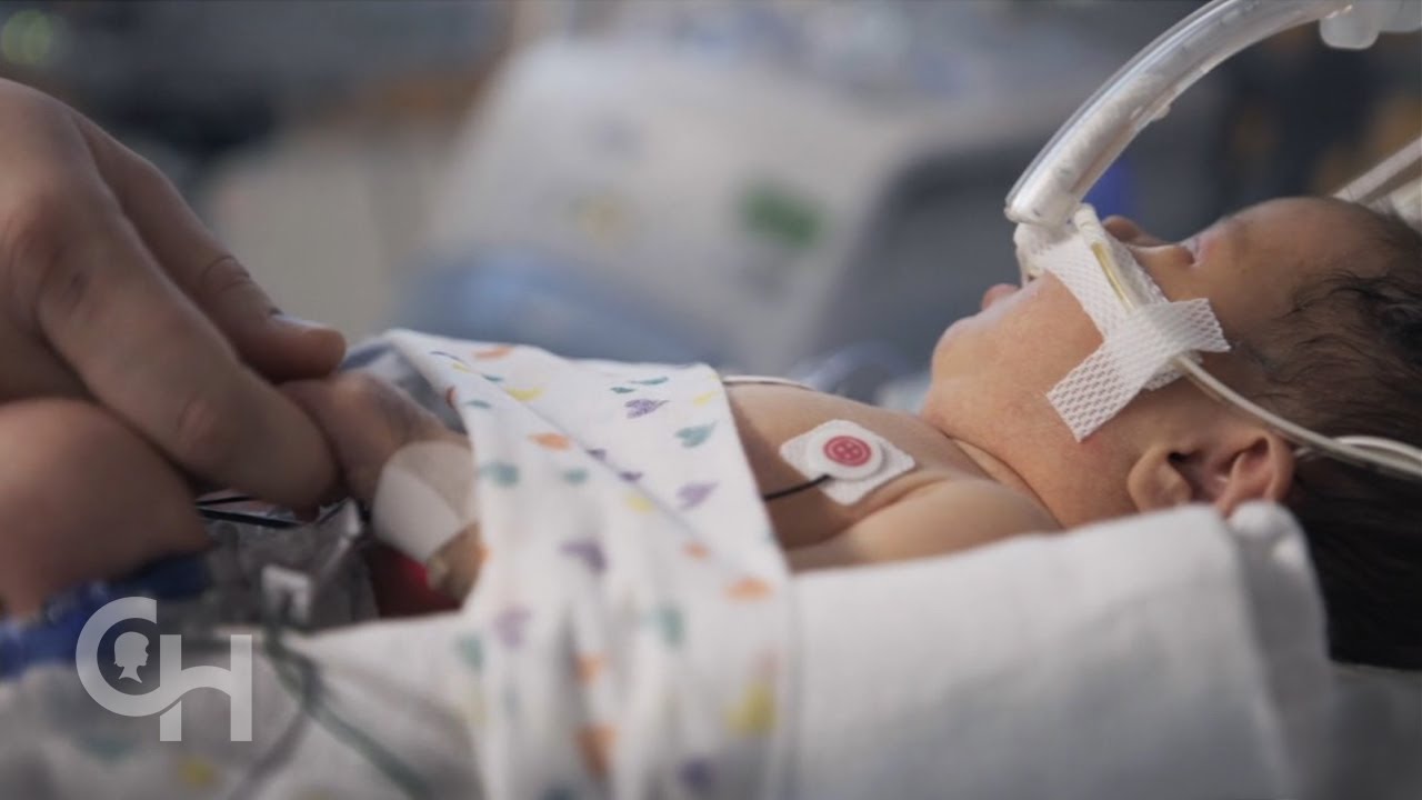 Congenital Diaphragmatic Hernia Repair: Lillian Jane’s CDH Story ...