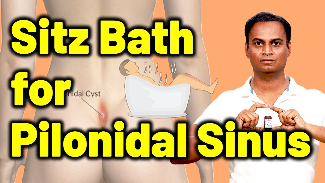 Sitz bath or Tub bath for Pilonidal Sinus Cyst Abscesses | Treatment ...