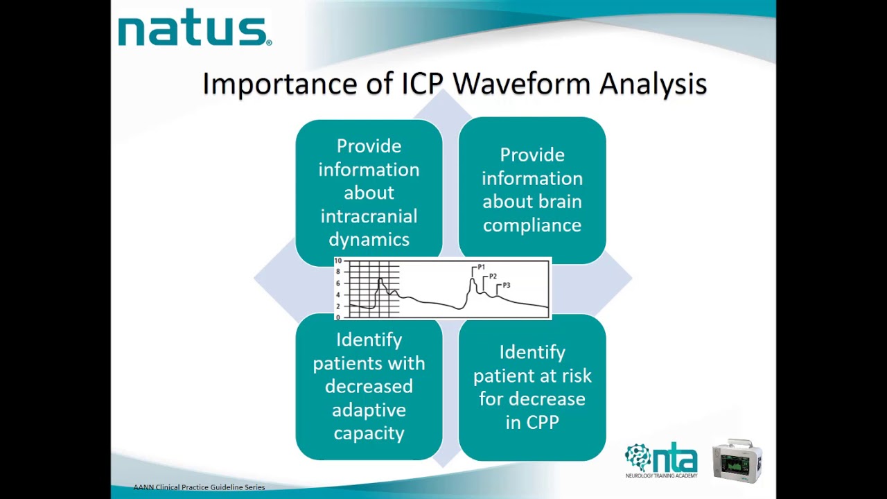 Natus Webinar: ICP Pulse Waveforms in Camino - YouTube