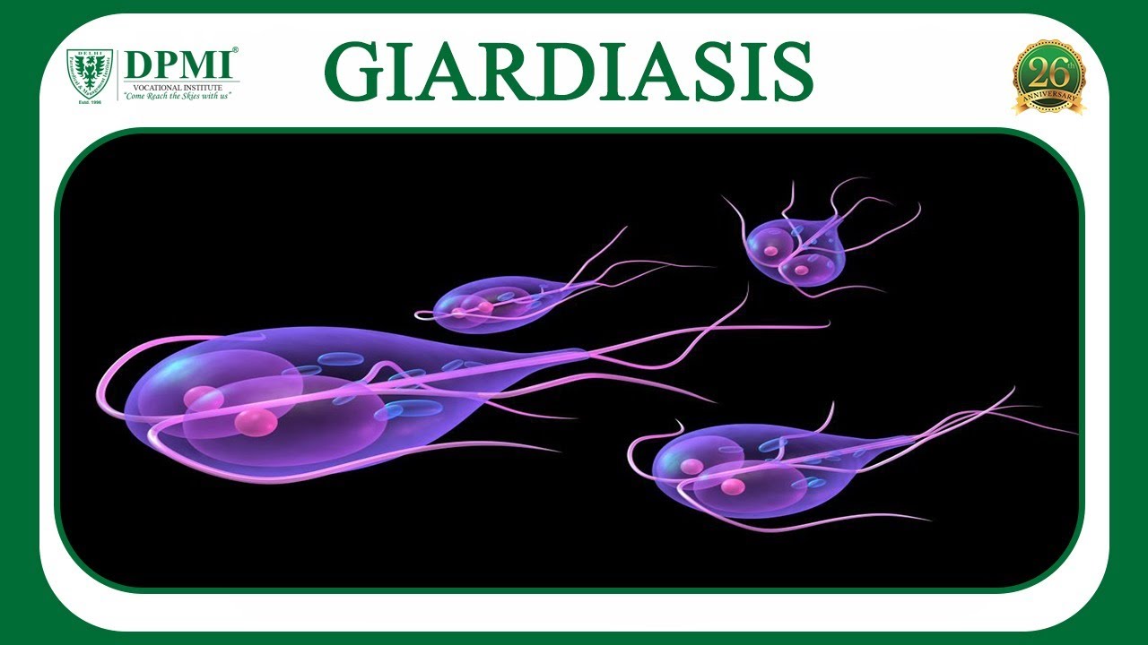 Giardiasis (Giardia Infection): What are the Symptoms of Giardiasis ...