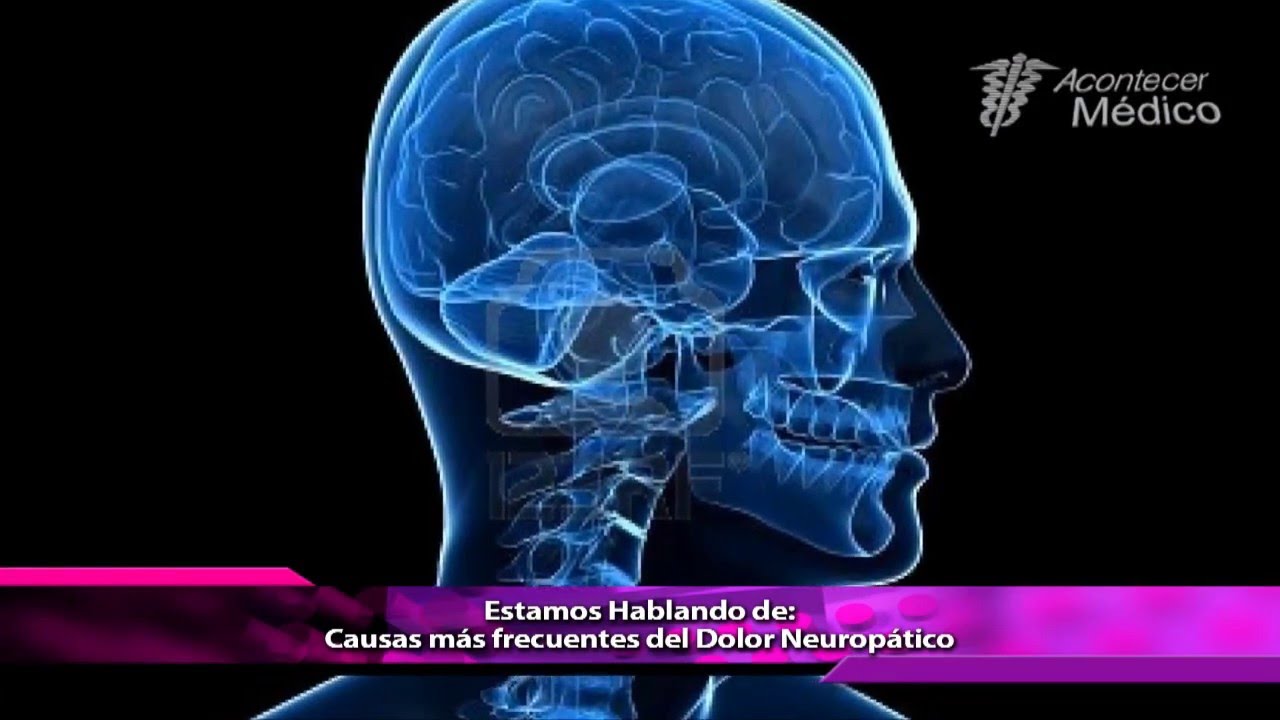 Causas más frecuentes del Dolor Neuropático - YouTube