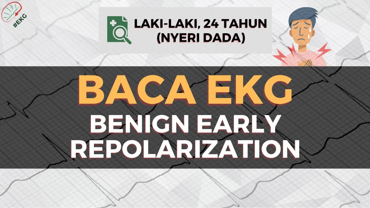 BACA EKG (BENIGN EARLY REPOLARIZATION) | EP.2 - YouTube