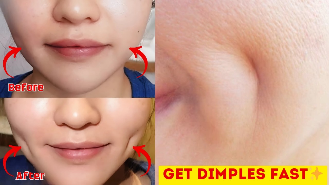 How to Get Dimples Naturally in Minutes! 😊 - YouTube