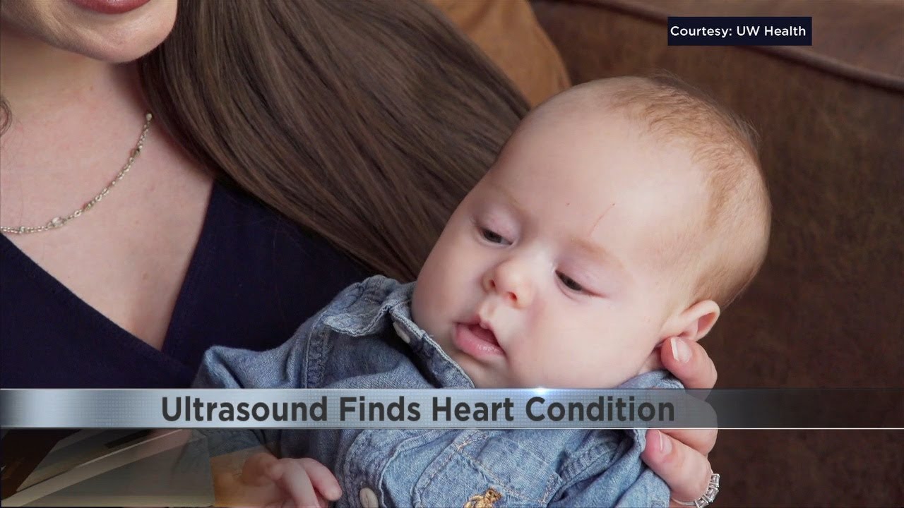 Routine ultrasound finds heart condition\ - YouTube