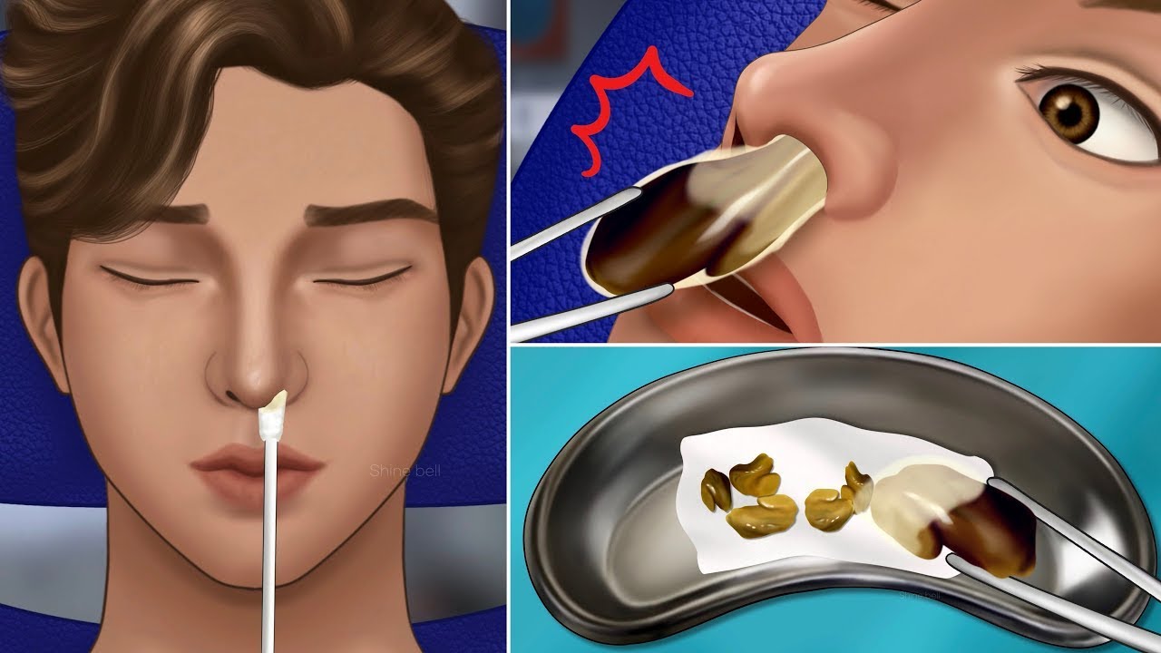 ASMR snot removal animation!!! #AnimationASMR #Animation #ASMR - YouTube