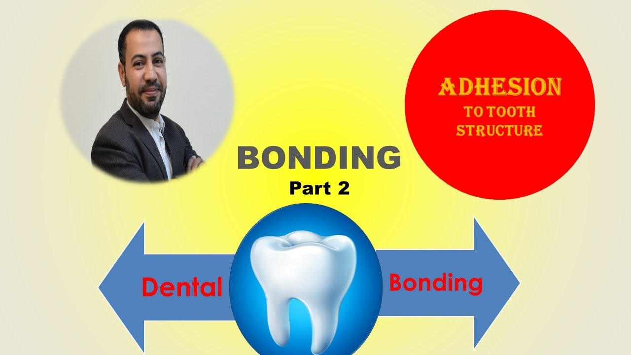 Adhesion to tooth structure (Bonding) part 2 - YouTube