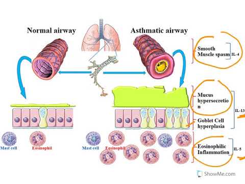 Respiratory pathophysiology 2 - YouTube