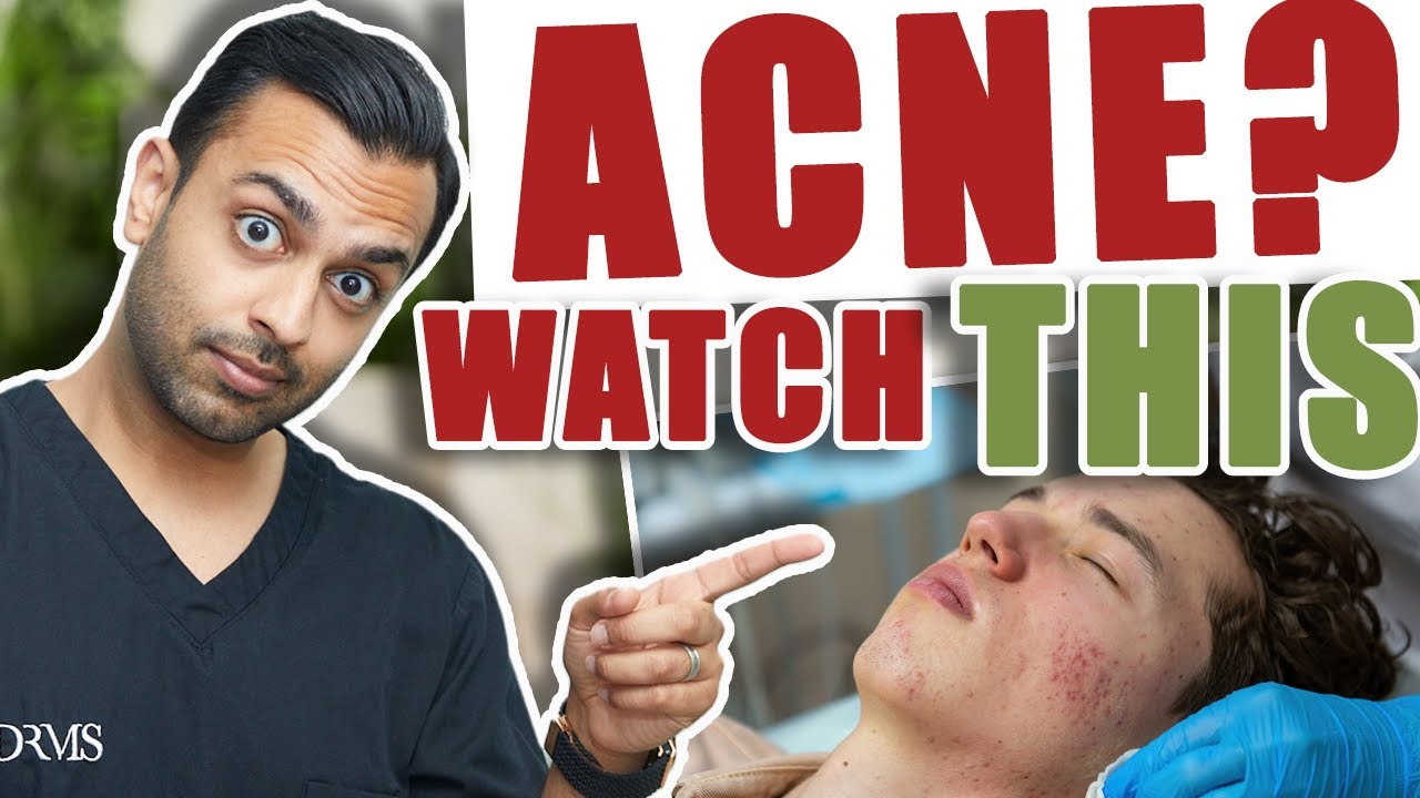 The Ultimate Guide to Fungal Acne: Causes and Solutions - YouTube