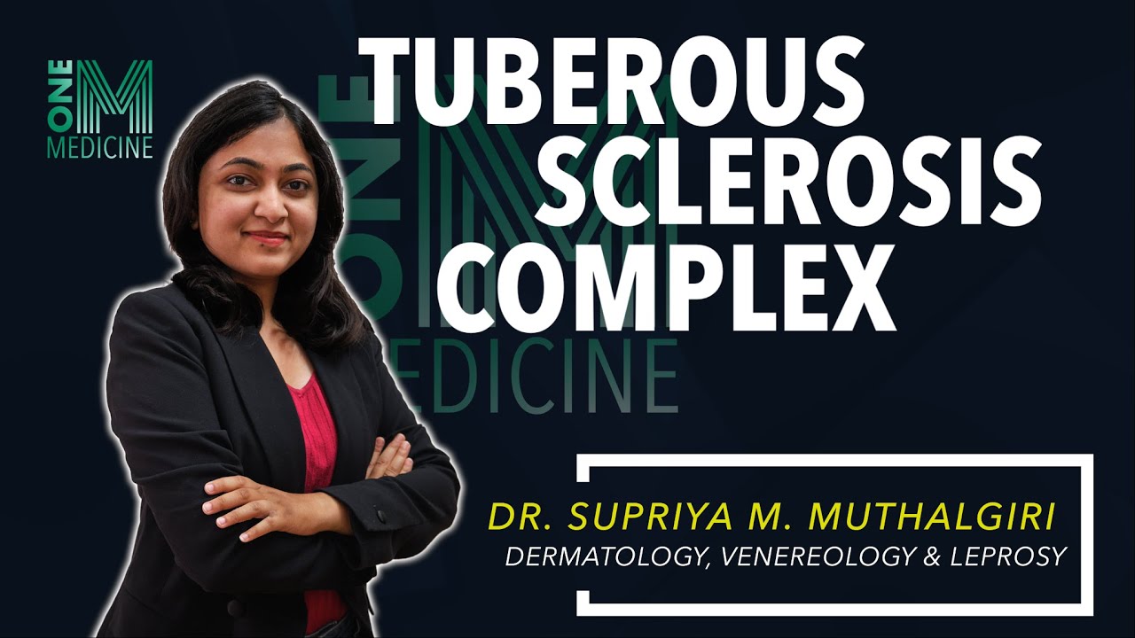 Chapter 9B | Tuberous Sclerosis Complex | Dermatology | OneMedicine ...