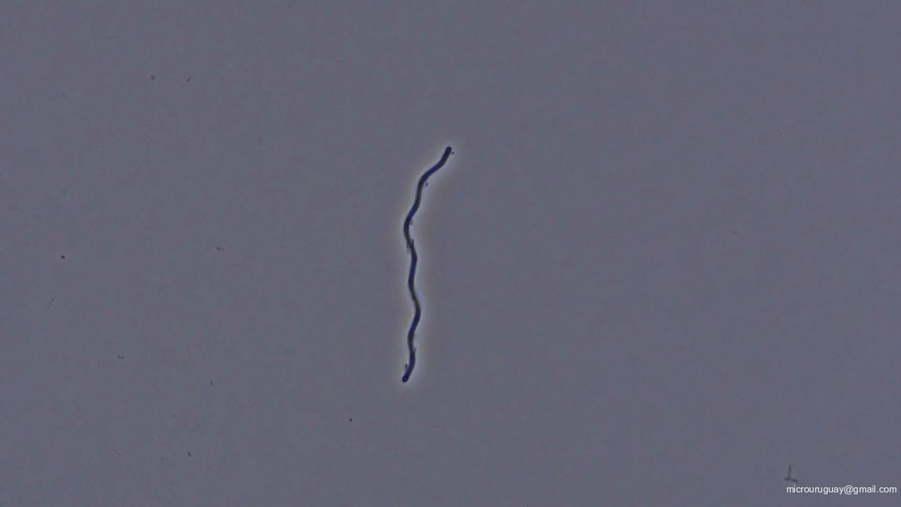 Parasitos en espirilos otro video - Parasites in spiral bacteria other ...