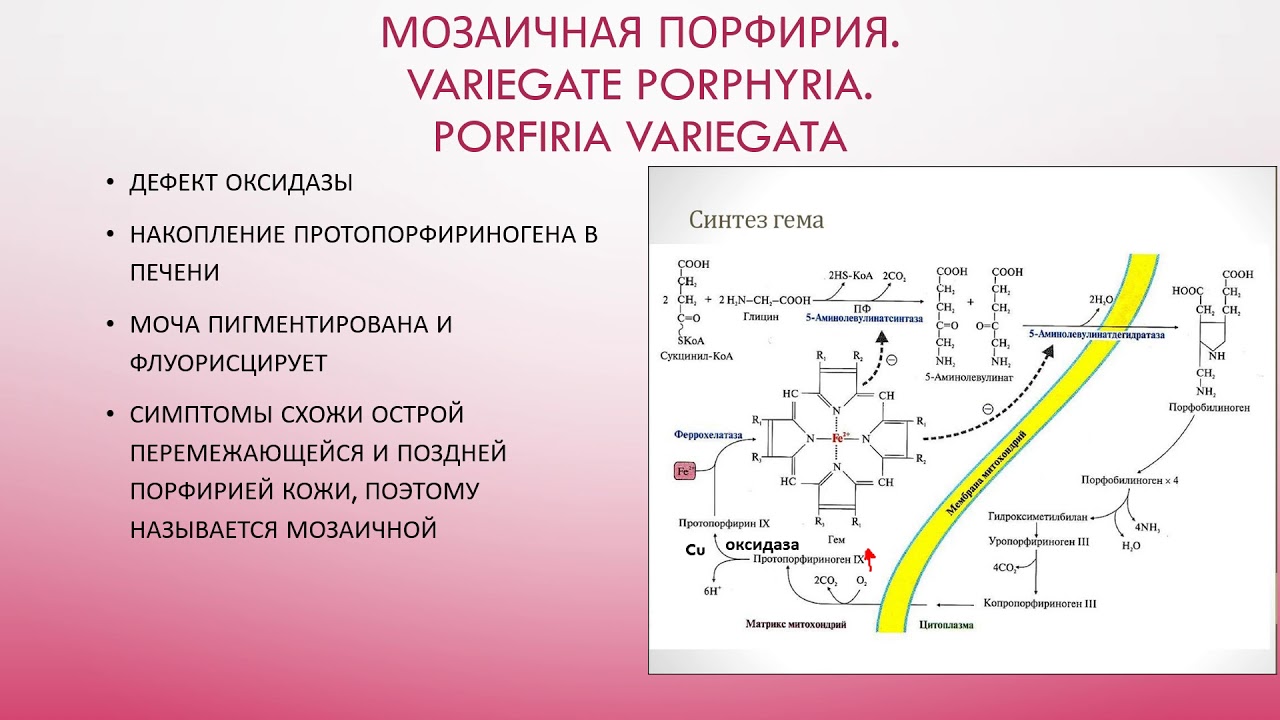 7 Мозаичная порфирия. Variegate porphyria. Porfiria variegata - YouTube