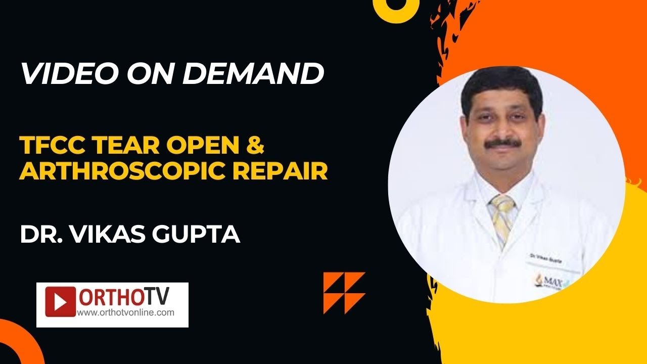 TFCC tear OPEN & Arthroscopic repair - Dr. Vikas Gupta - YouTube