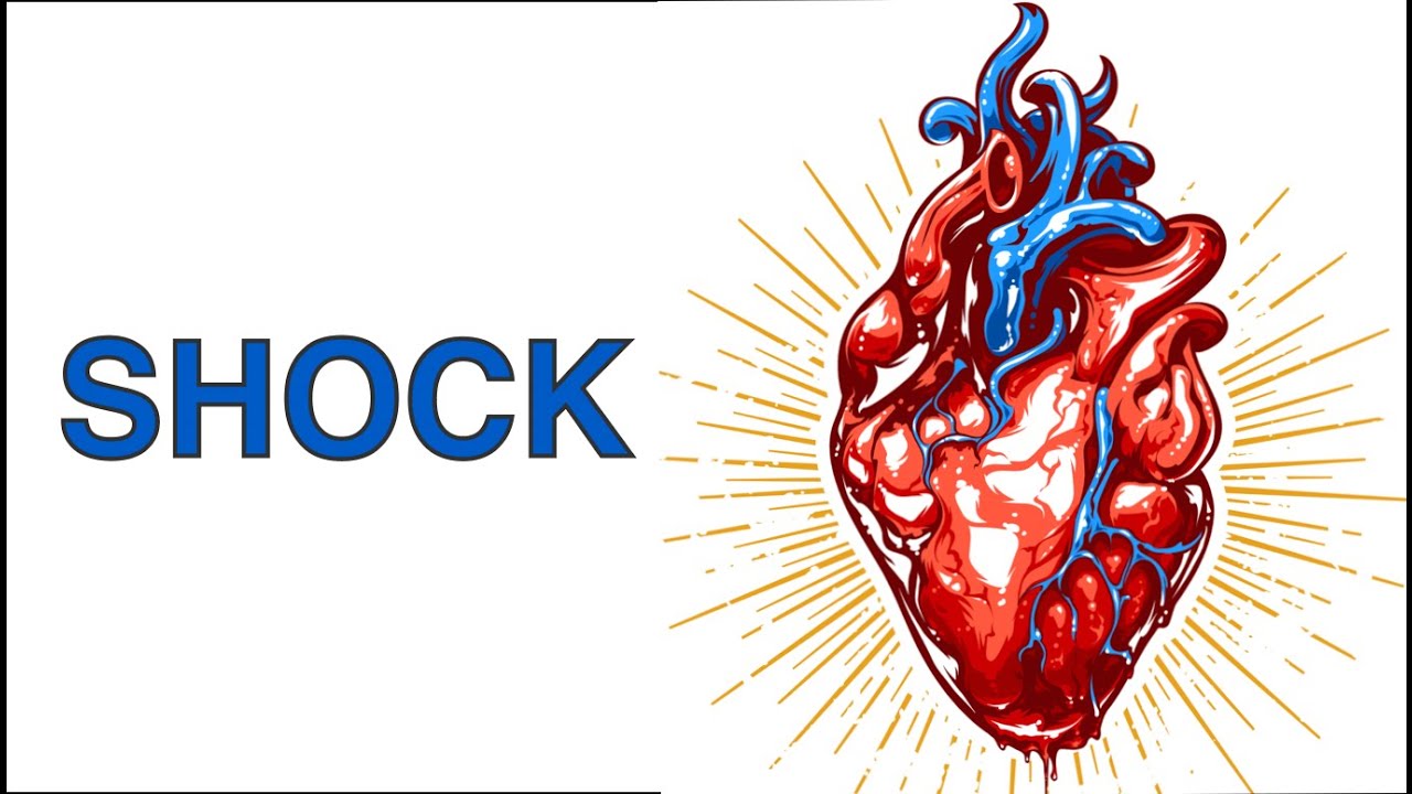 Shock Cardiogénico - YouTube