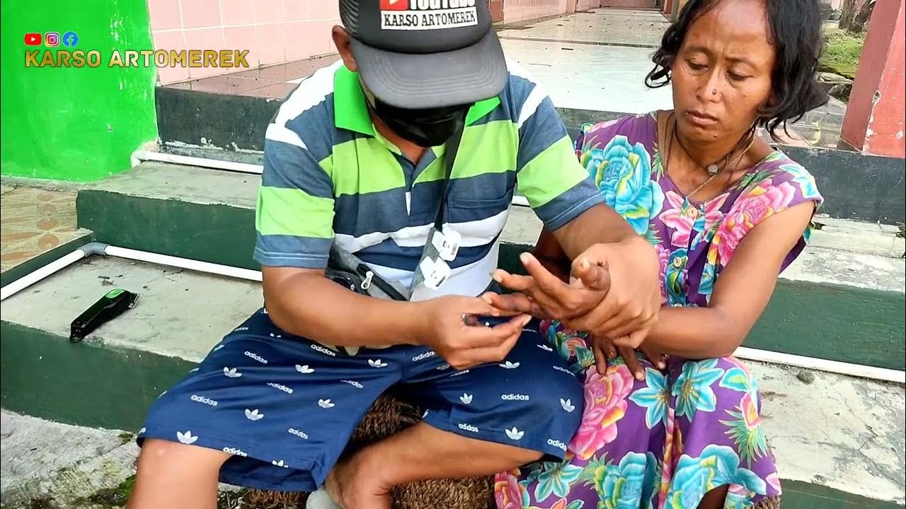 SEMUA JARI ODGJ CANTIK HAMPIR PUTSSS HARUS CEPAT TERKONFIRMASI KELUARGA NYA - YouTube