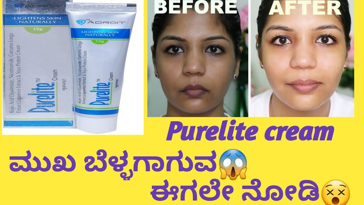 Purelite cream information in kannada|Uses|side effects| @healthcare595 ...