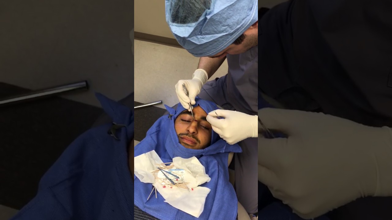 Eyelid Laceration - YouTube