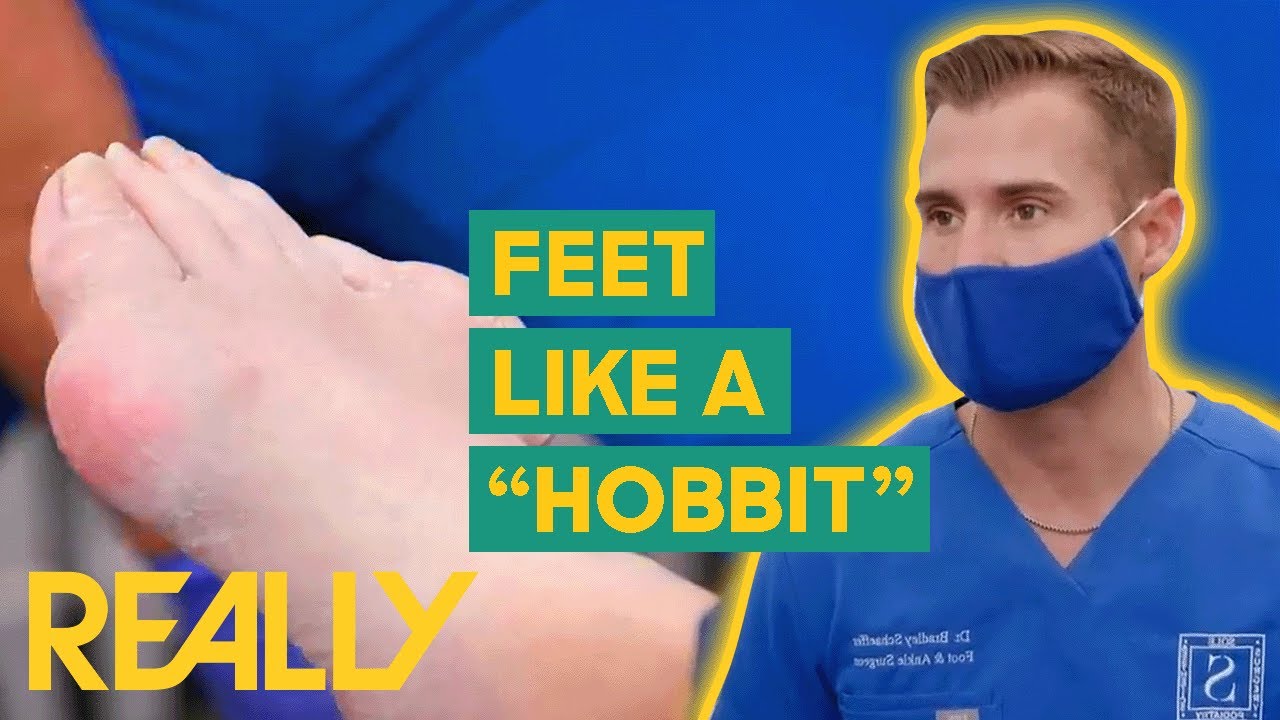 Patient’s Foot Looks Like A Hammerhead Shark | My Feet Are Killing Me ...