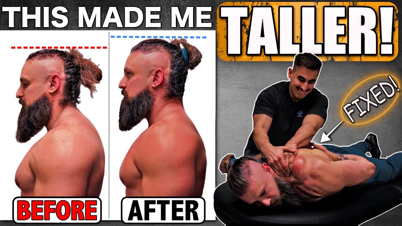 The WORST PAIN ️ Fixing Years Of Untreated BAD POSTURE Made Me Taller ...