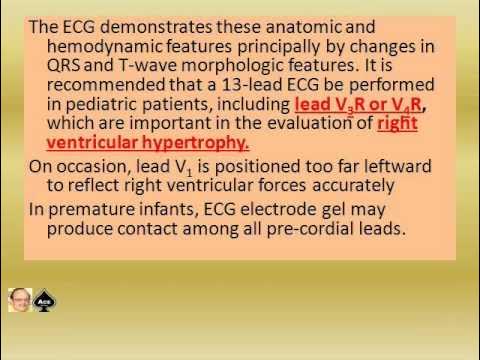 ECG tutorial Basic principles of ECG analysis Pediatric ECG 002 - YouTube