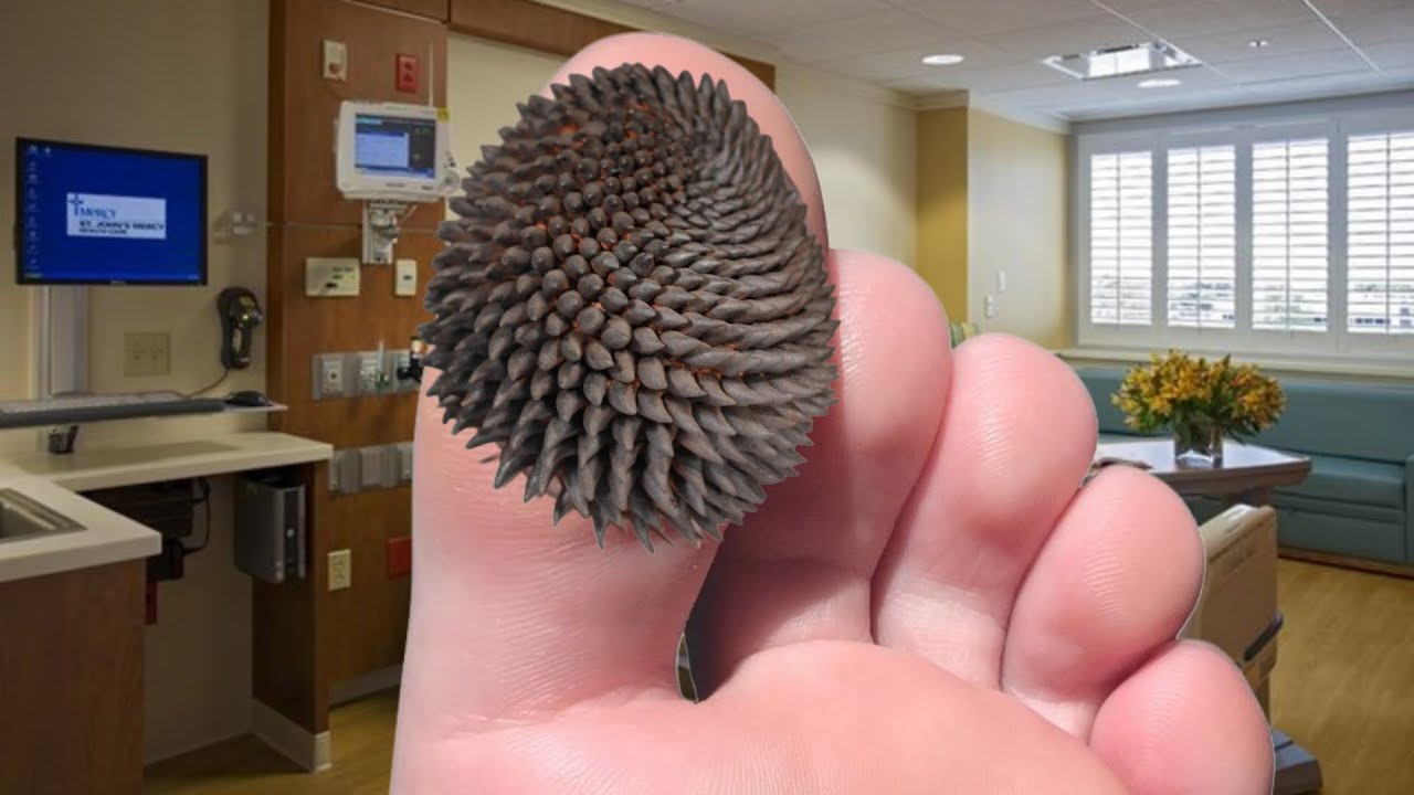 Asmr big toe infected treatment 2D animation asmr foot treatment asmr ...