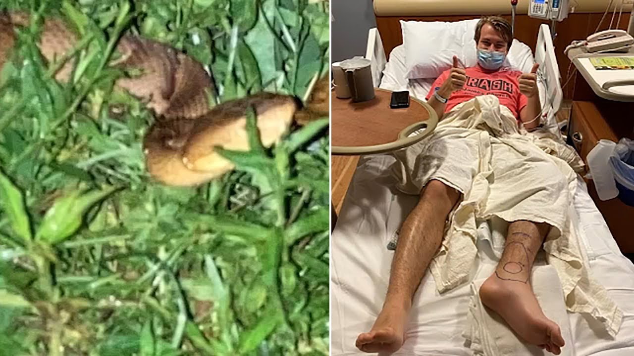Venomous snake bite lands man in ICU: 'I just felt a sharp sting right ...