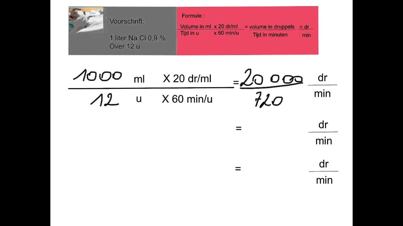infusiesnelheid standaard infuusleiding - YouTube