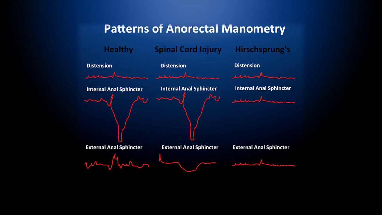 Anorectal Patterns, Norms and Case Studies - YouTube