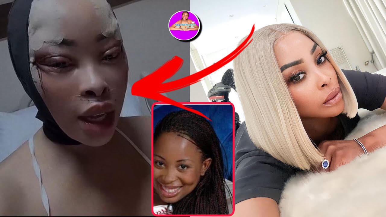 Khanyi Mbau gets surgery to change her whole Face😱😱 - YouTube