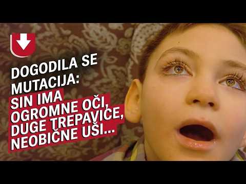 Moj sin ima Kabuki sindrom: Lilija | Biti mama